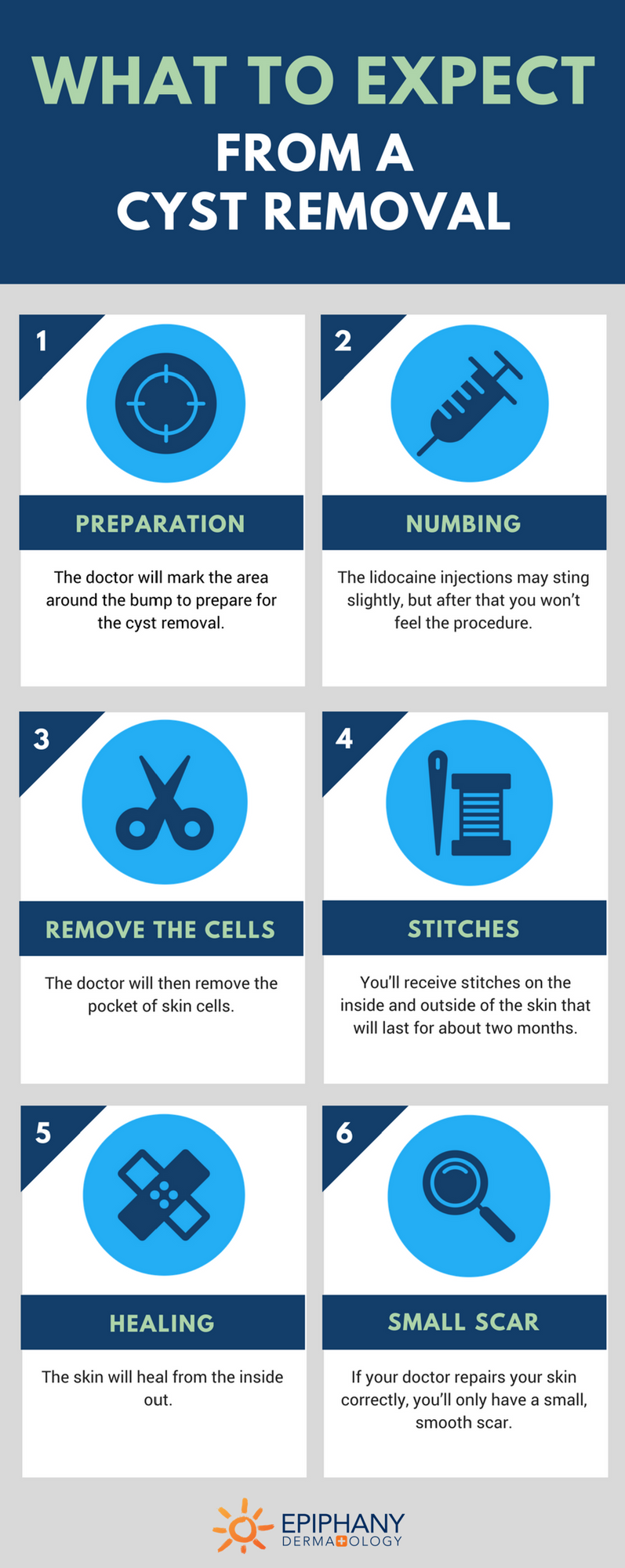 What To Expect From A Cyst Removal