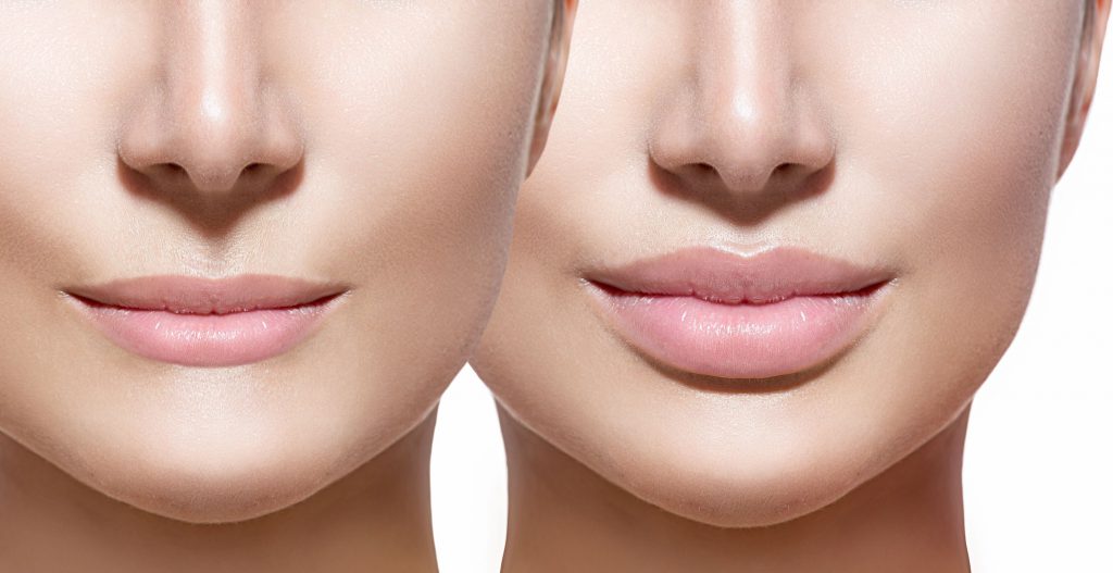 How To Make Your Lips Look Fuller | 3 Options for Plump Lips