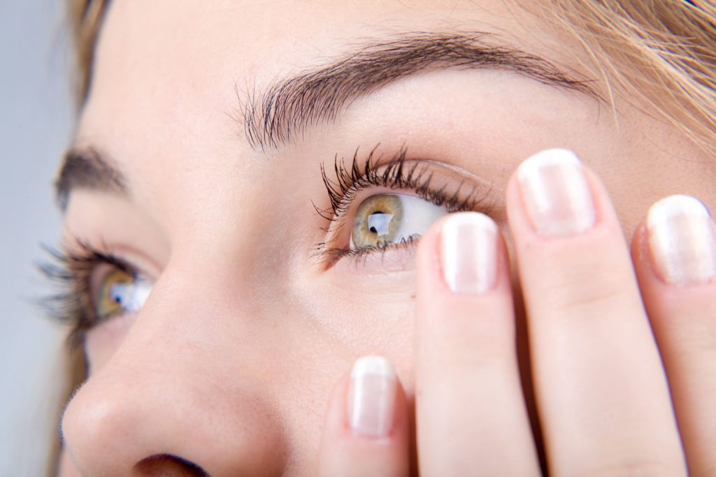 Tips for Preventing and Managing Melasma