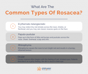 The Complete Guide to Rosacea Treatment | Epiphany Dermatology