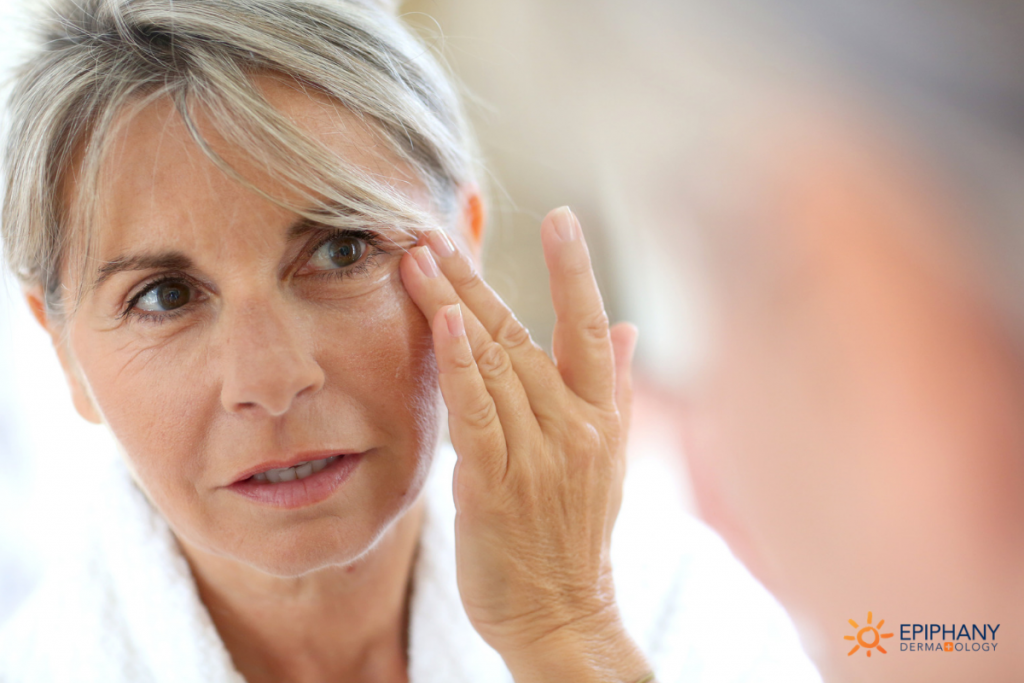 Are There Different Types Of Wrinkles? | Epiphany Dermatology