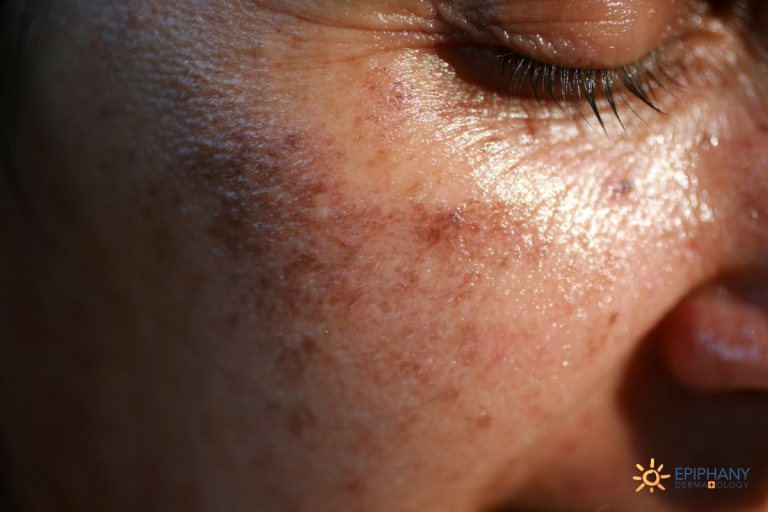 How to Reverse Sun Damage (Yes, Really) on Different Parts of Your Body