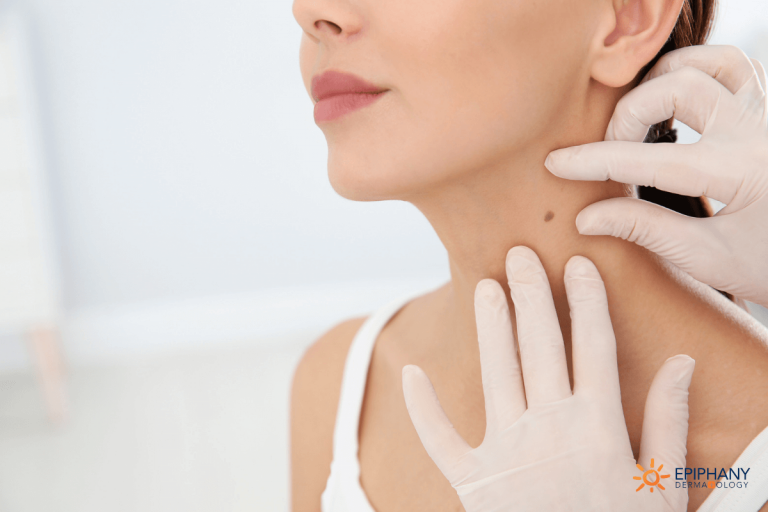 Why Mohs Surgery Is the Standard of Care for Skin Cancer Treatment