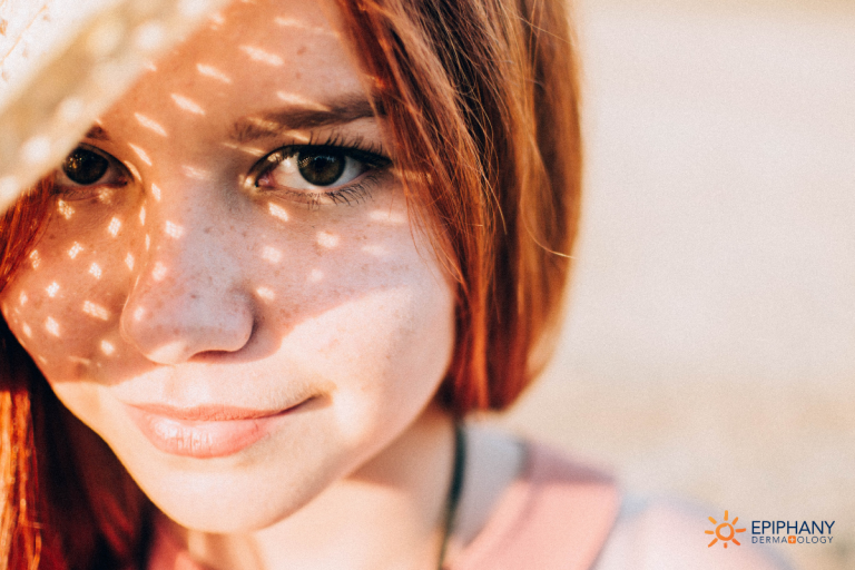 Photoaging: How to Treat and Preserve Healthier, Younger Looking Skin