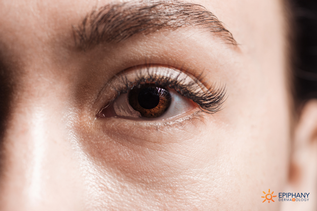 Photoaging: How to Treat and Preserve Healthier, Younger Looking Skin