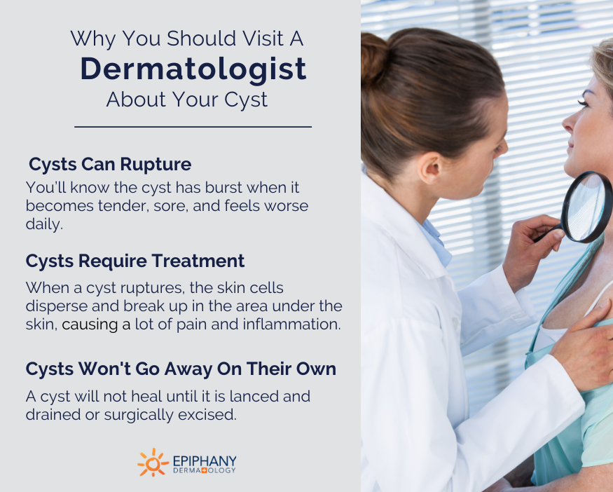 Skin Cysts When Is It Time To See A Dermatologist Skin Cysts When Is It Time To See A Dermatologist