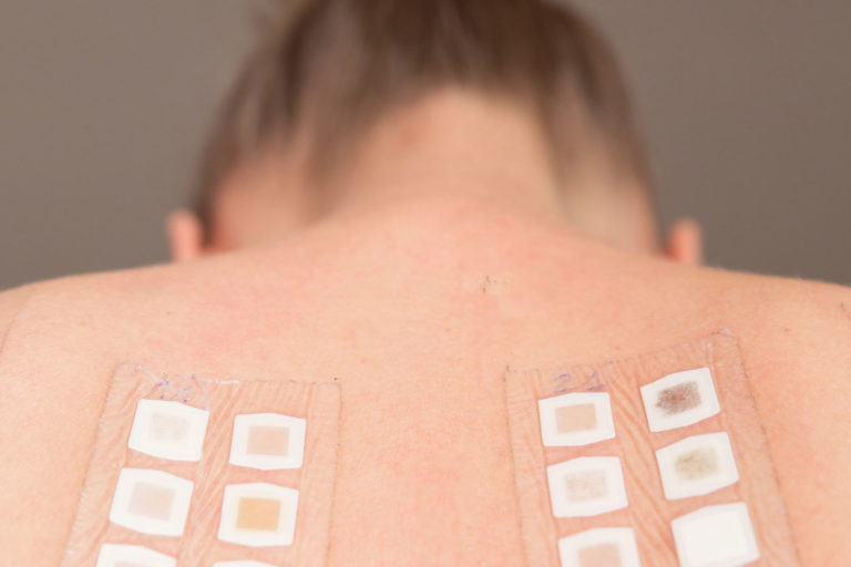 Got an itch you shouldn’t scratch? Find out what’s going on with patch ...